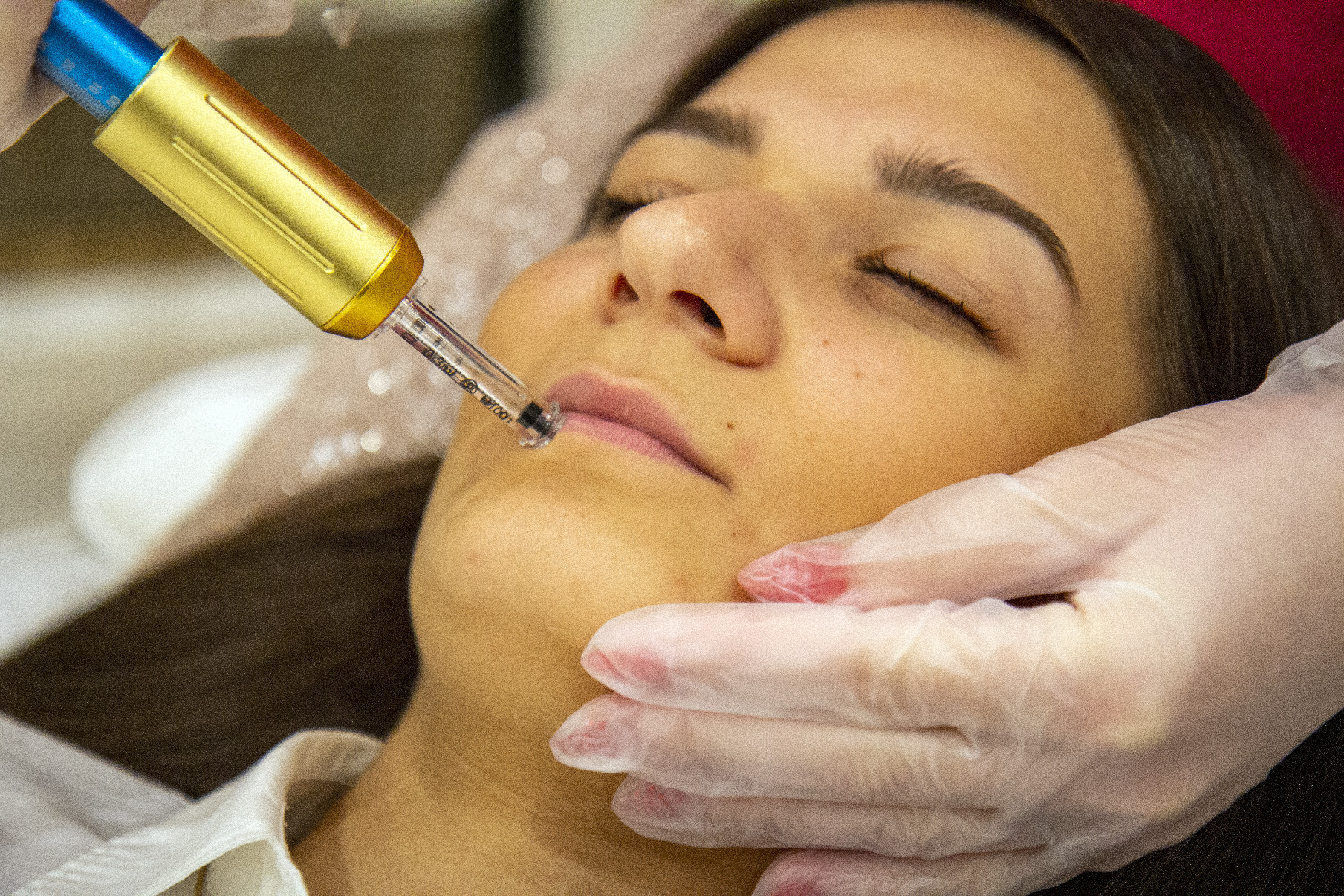 Prezenční kurz Hyaluron Pen - Dr Nek