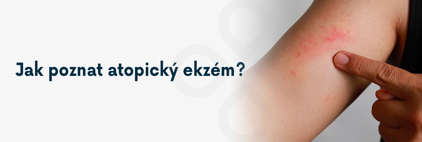 Jak poznat atopický ekzém? | LOBEY Laboratories s. r. o.