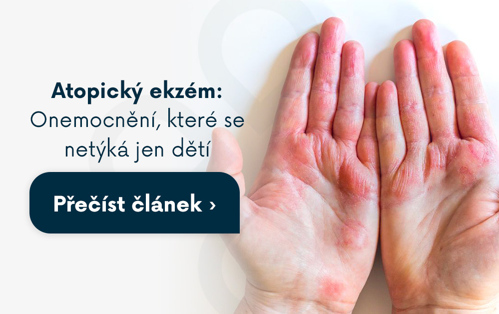 Atopický ekzém | LOBEY Laboratories s. r. o.