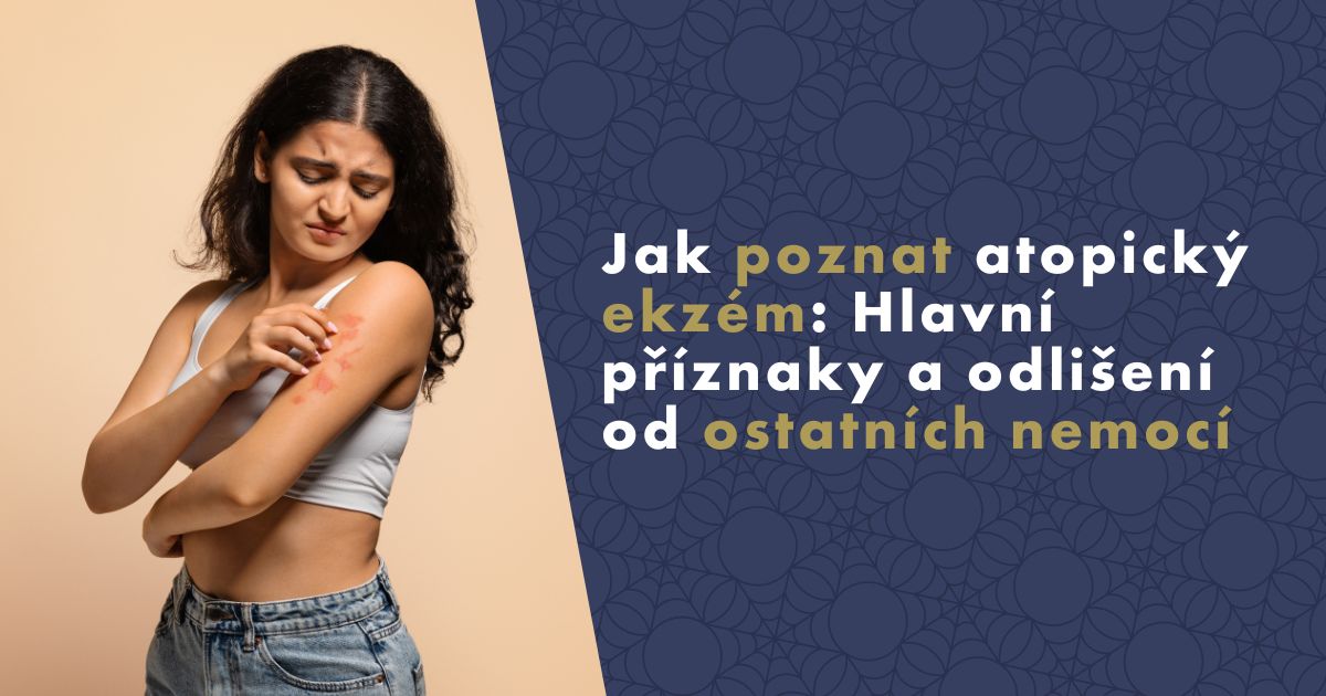 Jak poznat atopický ekzém: Hlavní příznaky