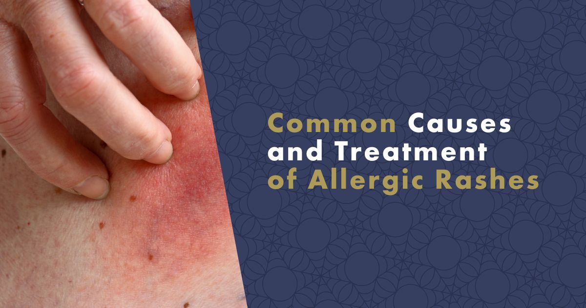 Common Causes and Treatment of Allergic Rashes