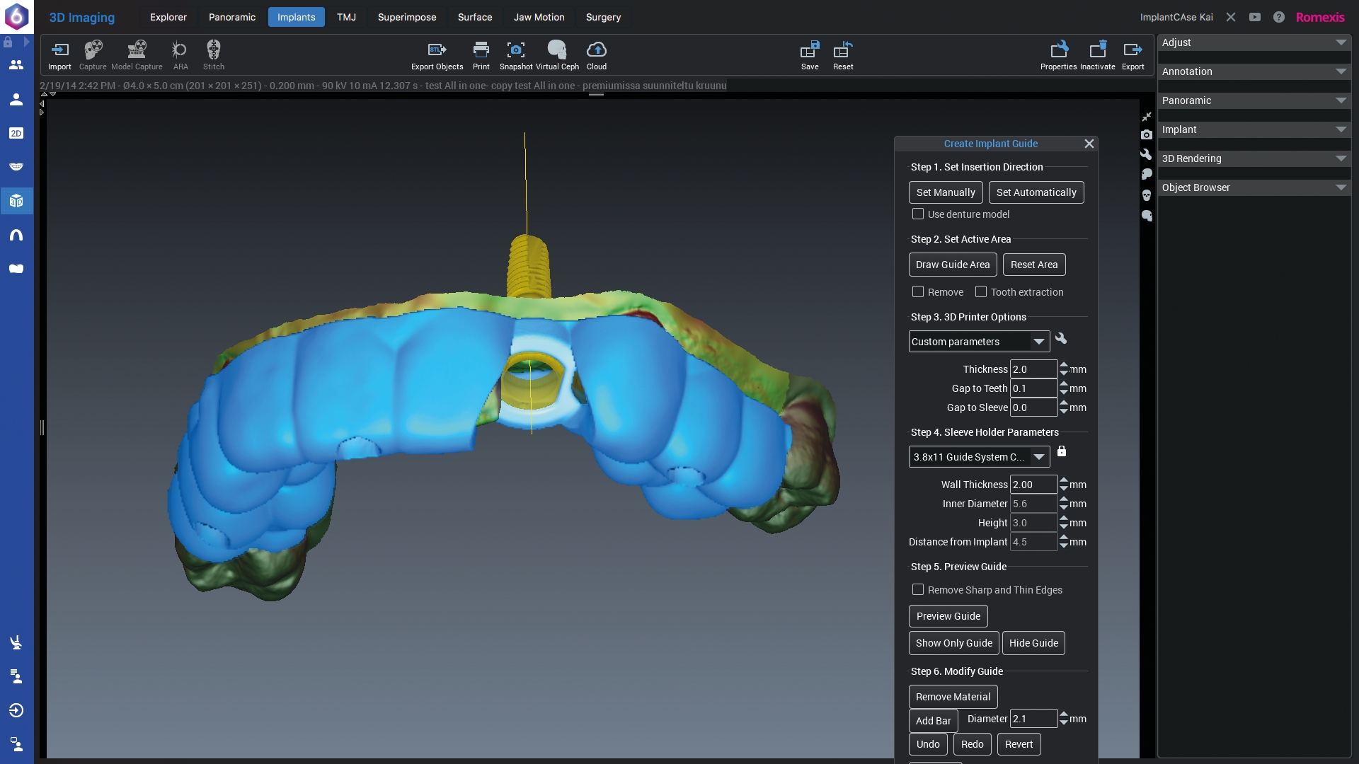 Planmeca Romexis Implant Guide - PRODENTA s.r.o.